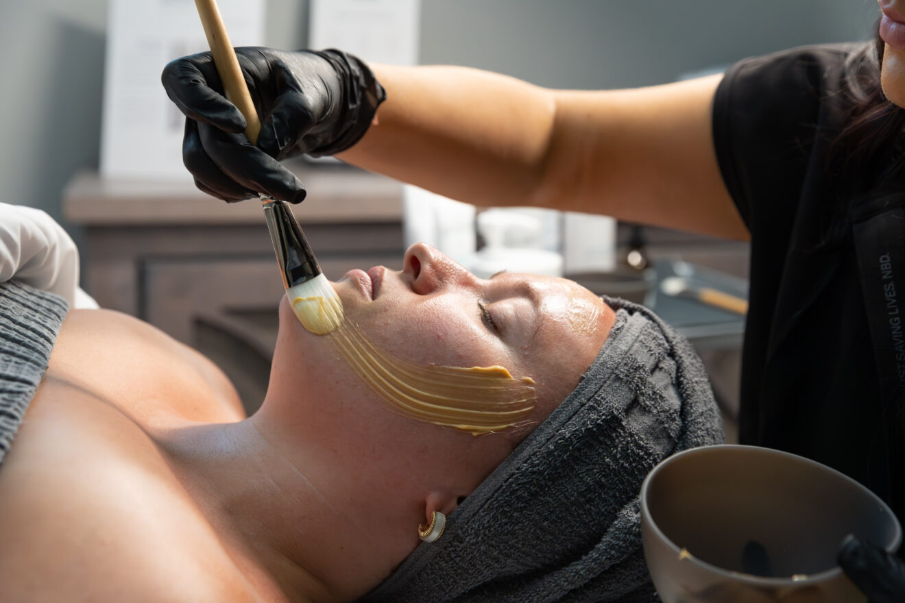 Facials in Waterloo - Spry Skin & Wellness Center